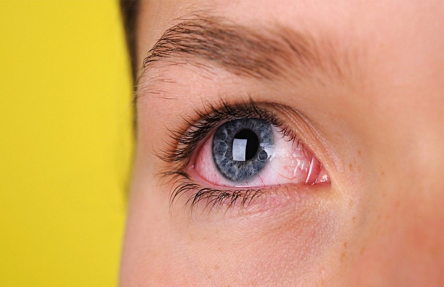 What Are The Worst Eye Diseases Scottmcadams